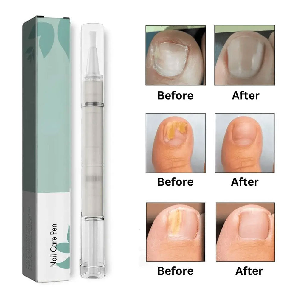 ClearNail Pro™ - Nail Care Pen-